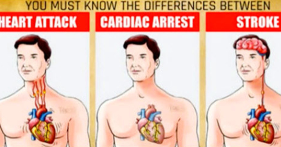 The Definitive Way To Know If You Are Having A Stroke Heart Attack Or